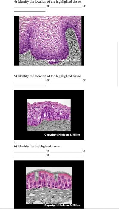 Solved 4) Identify the location of the highlighted tissue. | Chegg.com