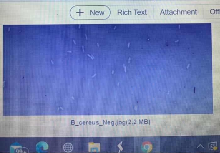 Solved Negative stain slides: You will see the name of the | Chegg.com