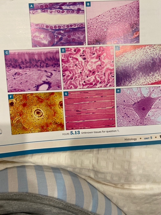 Solved B А с H FIGURE 5.13 Unknown tissues for question 1. | Chegg.com