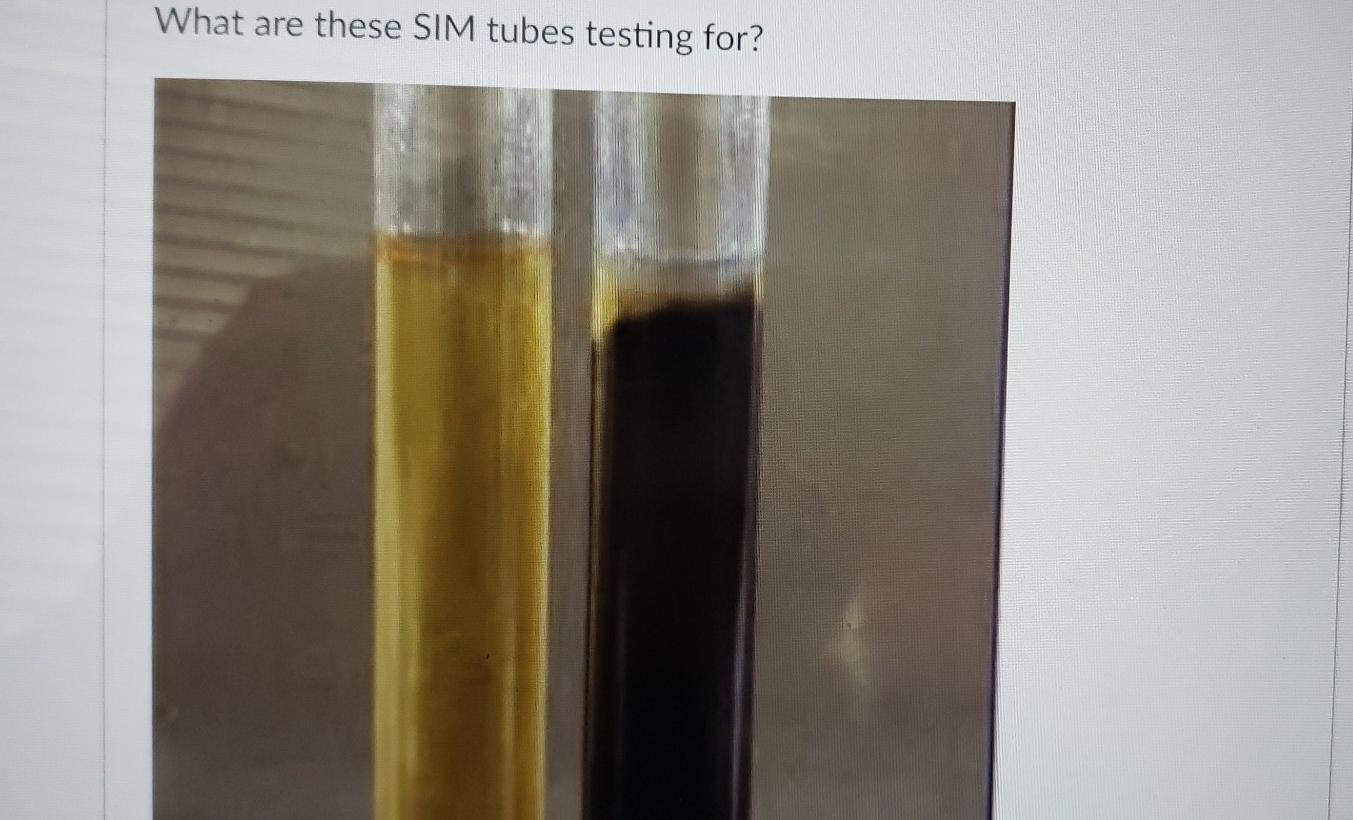 Solved What are these SIM tubes testing for? | Chegg.com