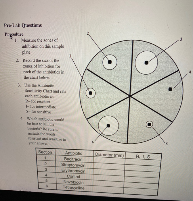 Solved Pre-Lab Questions Procedure 1. Measure the zones of | Chegg.com