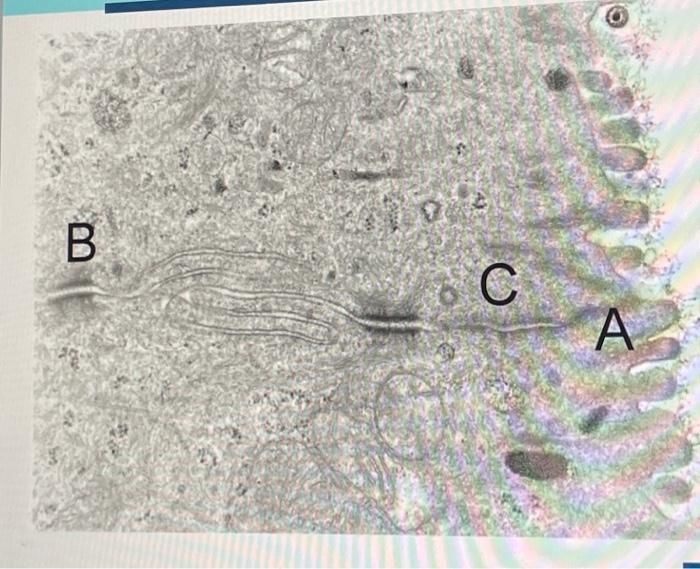Solved B C A | Chegg.com