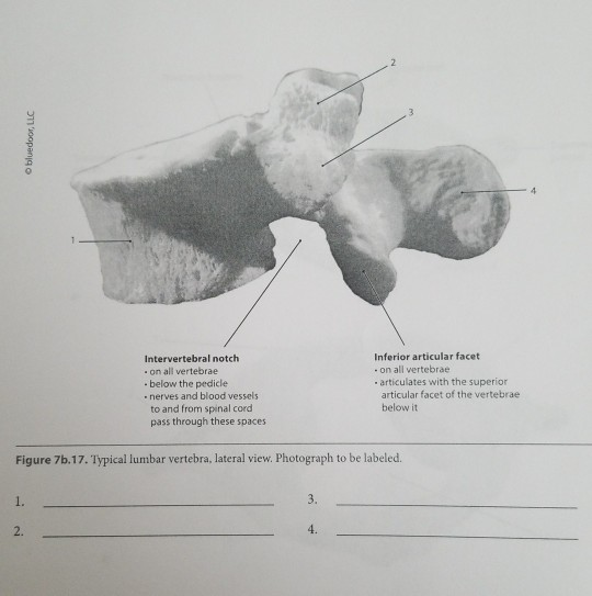 bluedoor, LLC 4 Intervertebral notch on all vertebrae | Chegg.com