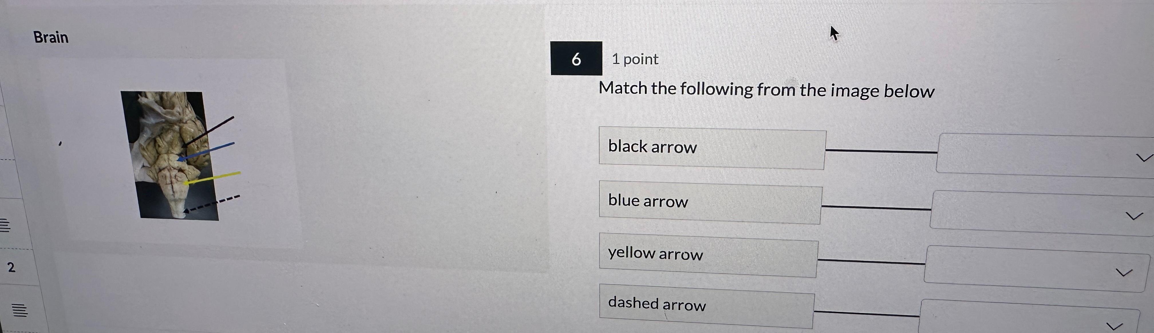 Solved Brain61 ﻿pointMatch the following from the image | Chegg.com