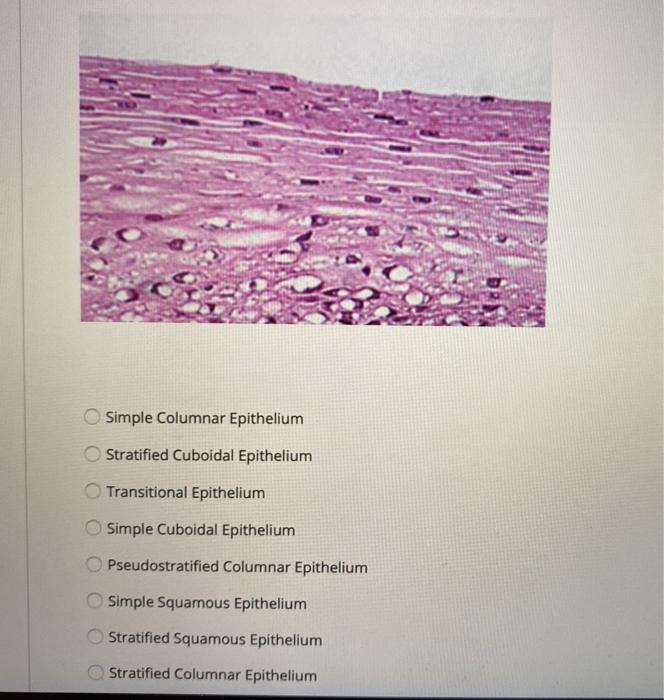 Solved Elastic Cartilage Dense Regular Elastic Connective | Chegg.com