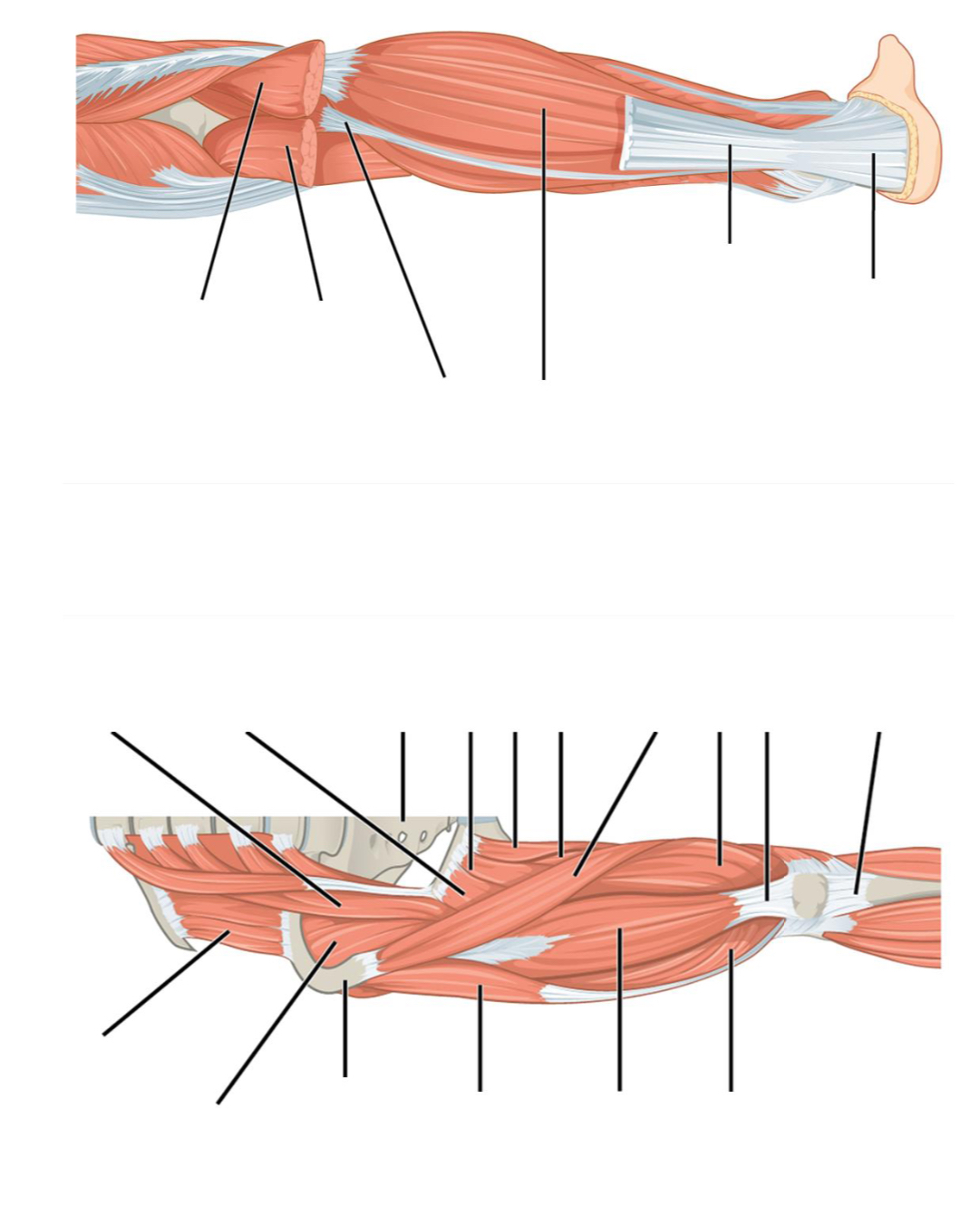 Solved Please label the indicated muscles on the diagram | Chegg.com