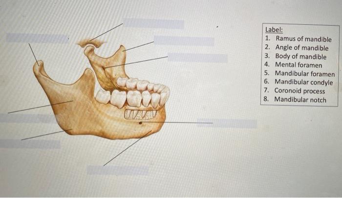 Solved Label: 1. Ramus of mandible 2. Angle of mandible 3. | Chegg.com