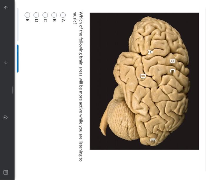 Solved Which of the following brain areas will be more | Chegg.com