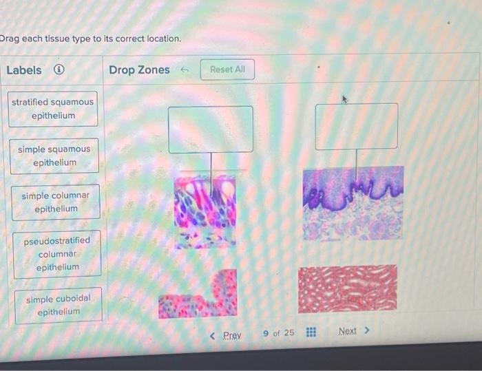 Solved Drag each tissue type to its correct location. | Chegg.com