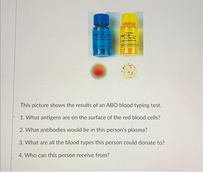 Solved This picture shows the results of an ABO blood typing | Chegg.com