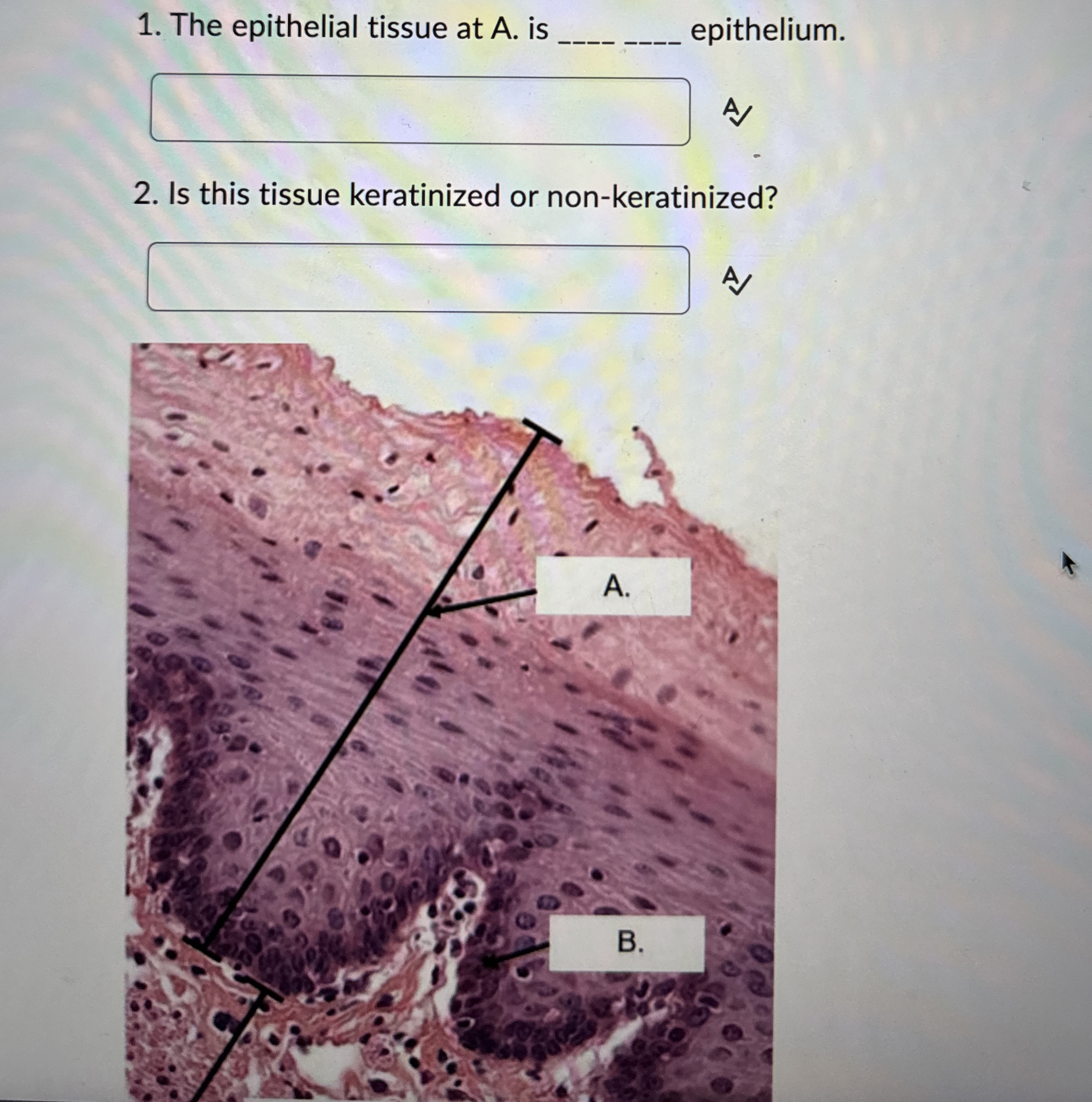Solved The epithelial tissue at A. ﻿is q, ﻿epithelium. ﻿AIs | Chegg.com