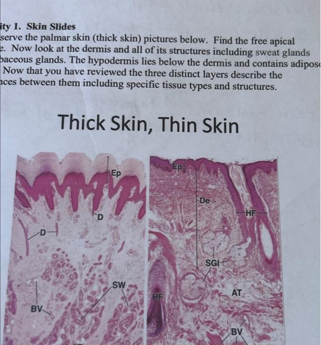 ity 1. Skin Slides serve the palmar skin (thick skin) | Chegg.com