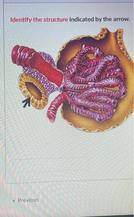 Solved Identify the structure indicated by the arrow. We | Chegg.com