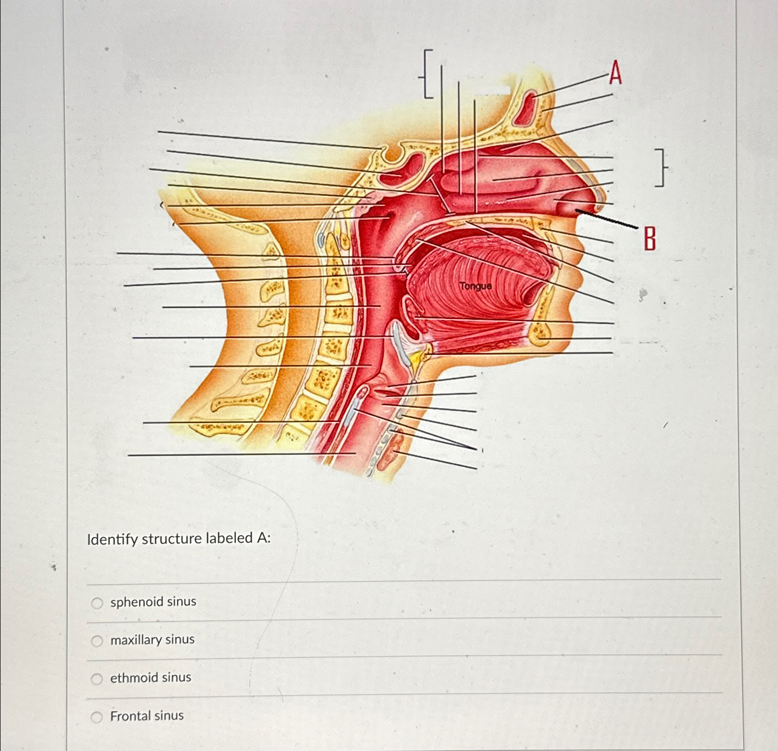Solved Identify structure labeled A ﻿:sphenoid | Chegg.com