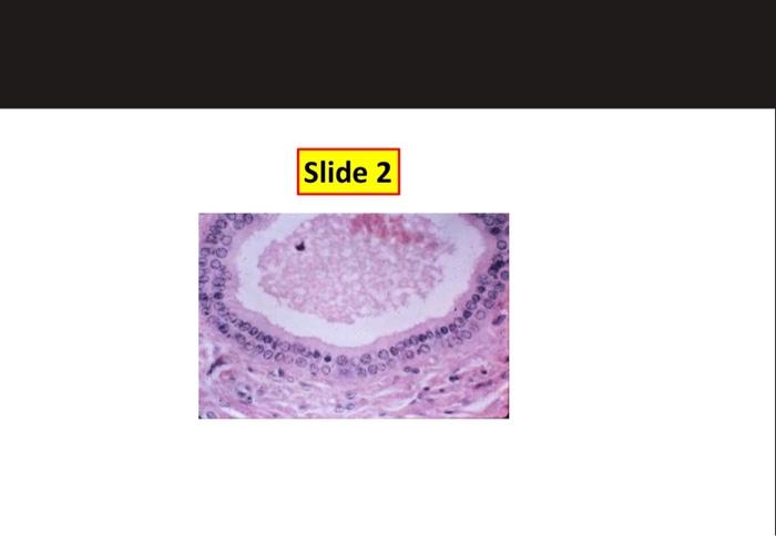 Solved what type of epithelium tissue is this? also the | Chegg.com