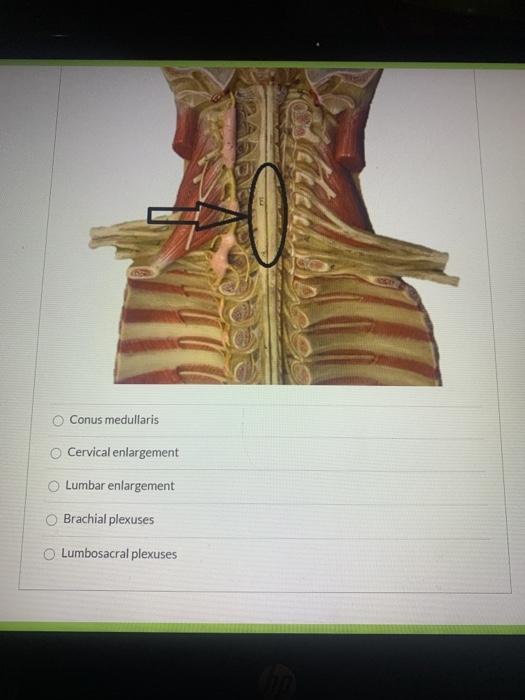 Solved E Conus medullaris Cervical enlargement Lumbar | Chegg.com