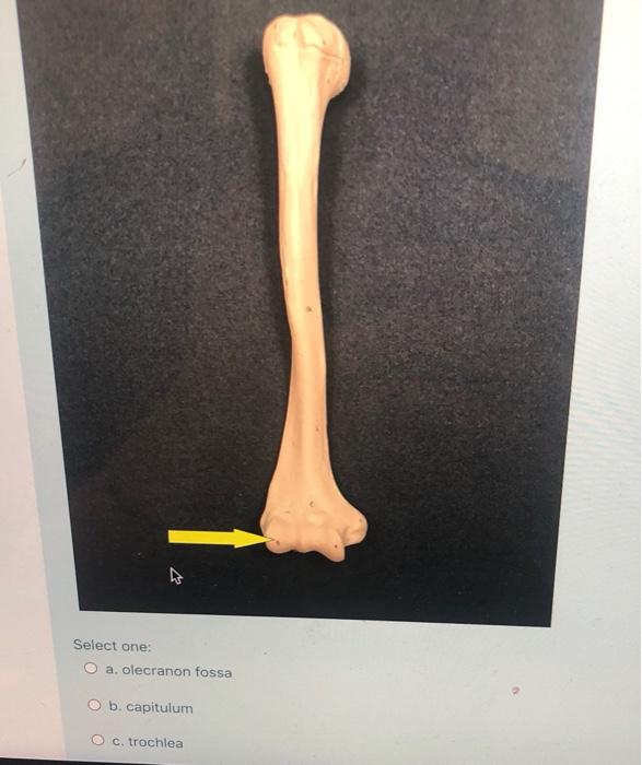 Solved hed Select one: O a. olecranon fossa O b. capitulum O | Chegg.com