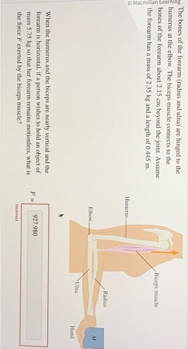 Solved The bones of the forearm (radius and ulna) are hinged | Chegg.com