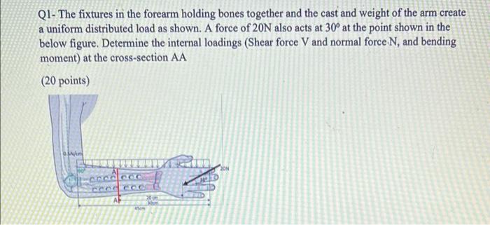Solved Q1- The fixtures in the forearm holding bones | Chegg.com