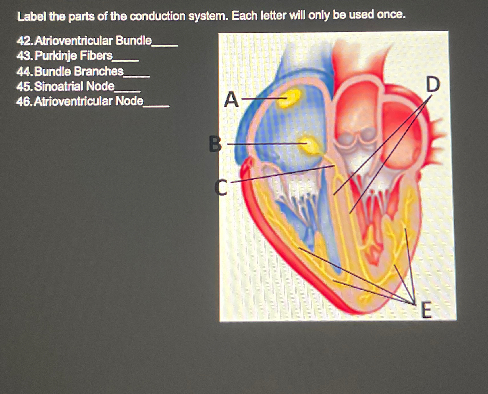 Solved Label the parts of the conduction system. Each letter | Chegg.com