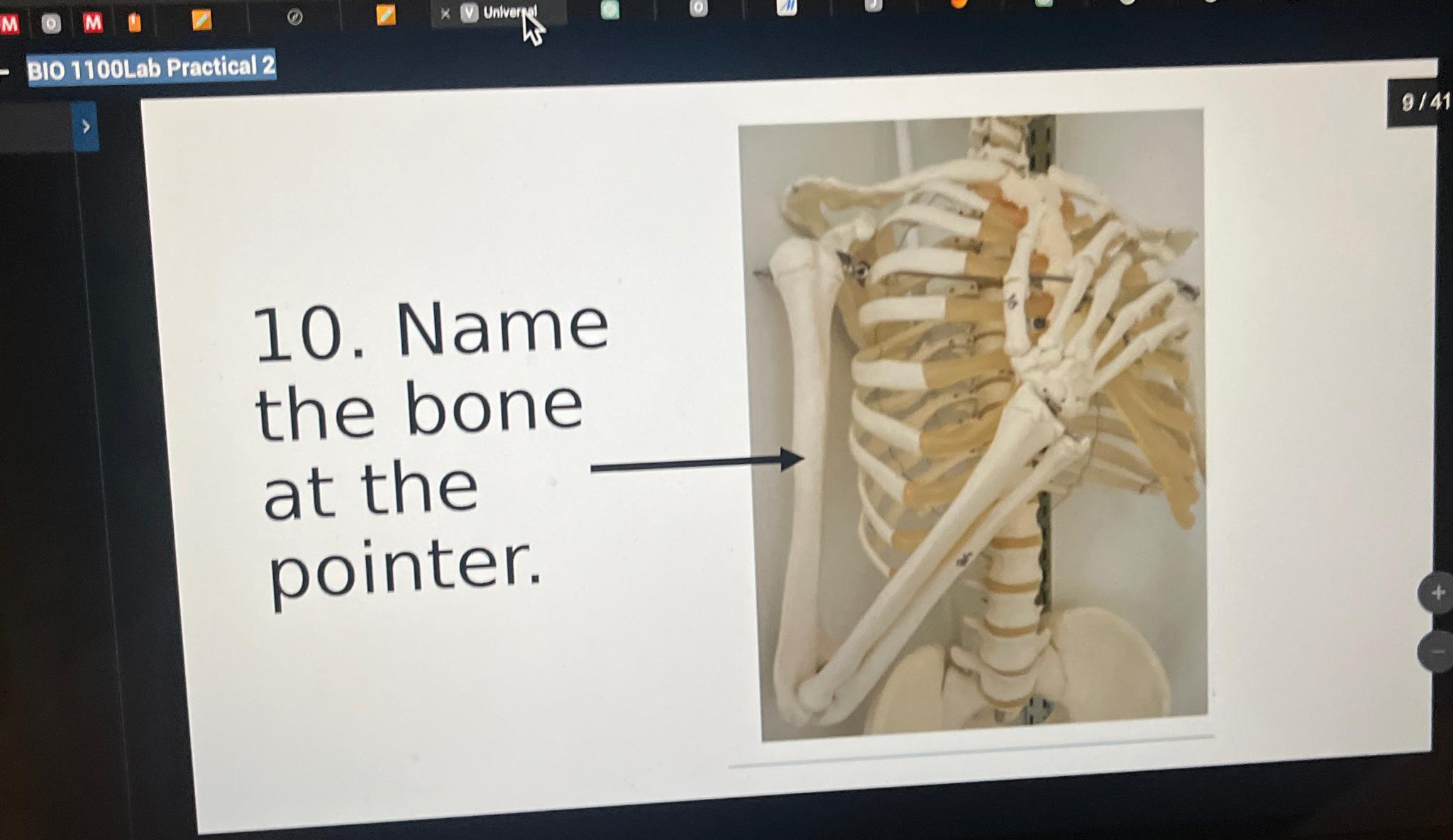 Solved Name the bone at the pointer. | Chegg.com