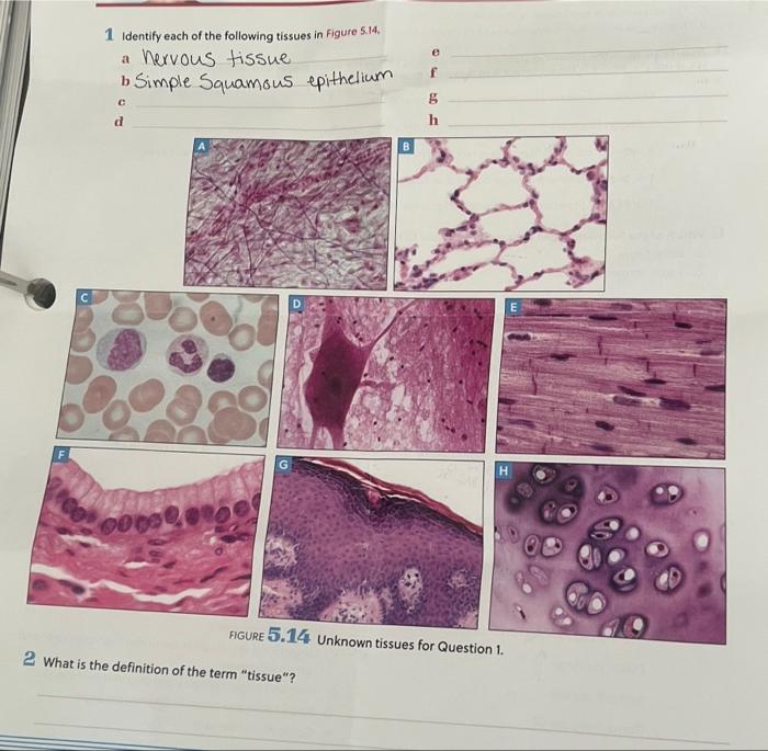 Solved 1 Identify each of the following tissues in figure | Chegg.com