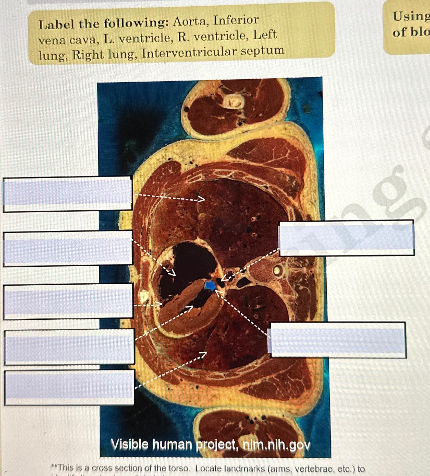 Solved Label the following: Aorta, Inferior vena cava, L. | Chegg.com