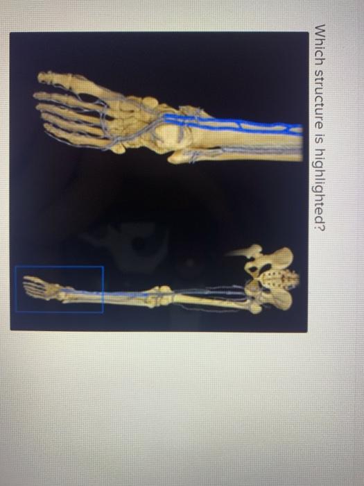 Solved Which structure is highlighted? interosseous veins | Chegg.com