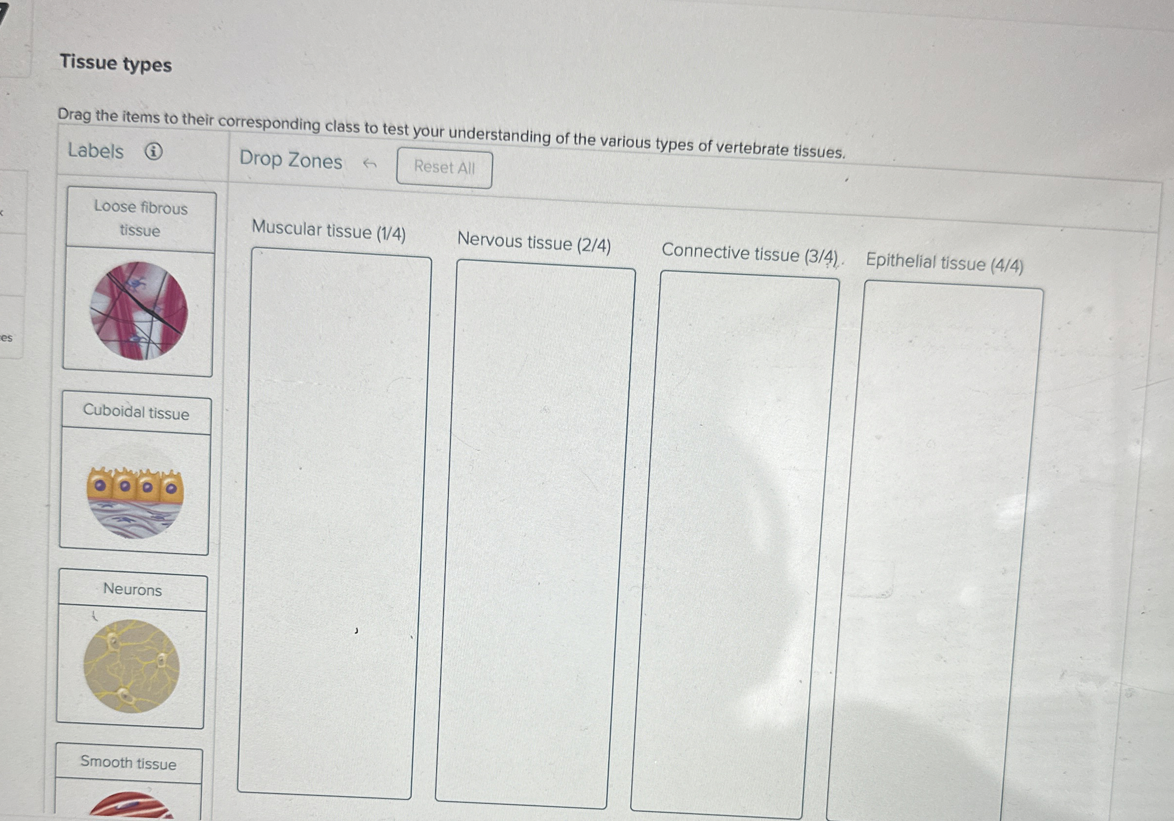 Solved Tissue typesDrag the items to their corresponding | Chegg.com