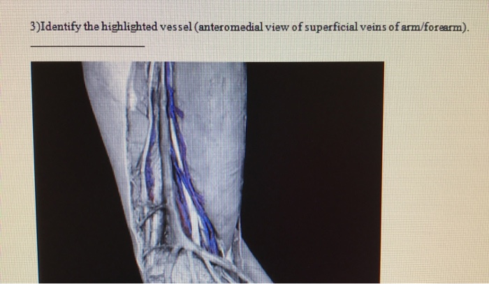 Solved 1) Identify the highlighted vessels. 2) Identify | Chegg.com