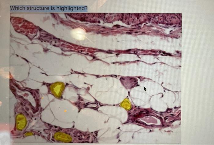 Solved Which structure is highlighted? Which structure is | Chegg.com