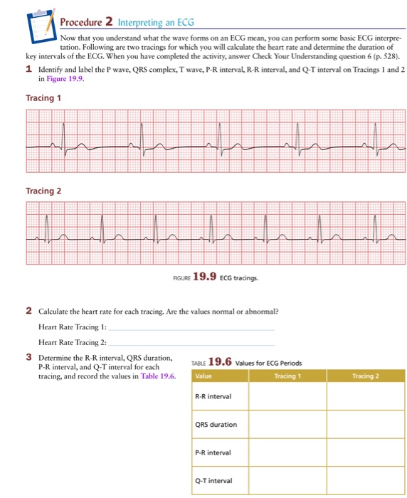 Solved Procedure 2 Interpreting an ECG Now that you | Chegg.com