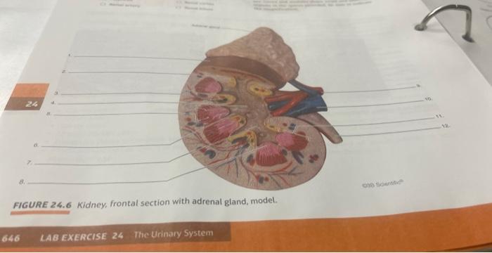 FIGURE 24.6 Kidney, frontal section with adrenal | Chegg.com