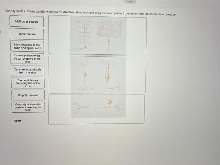 Solved Identify each of these variations in neuron | Chegg.com