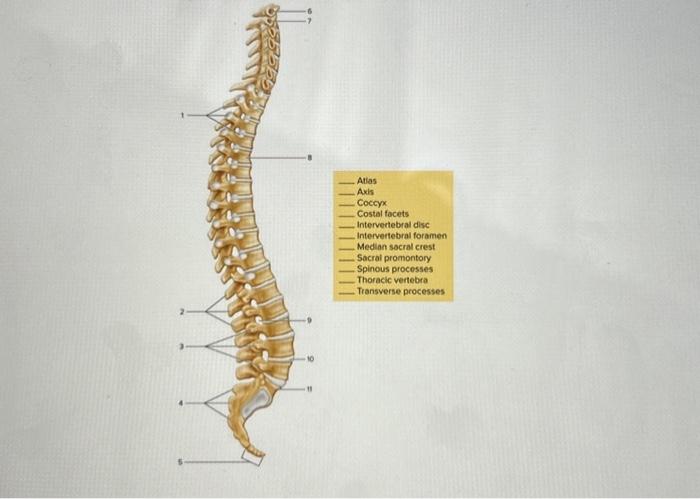 Solved label please | Chegg.com