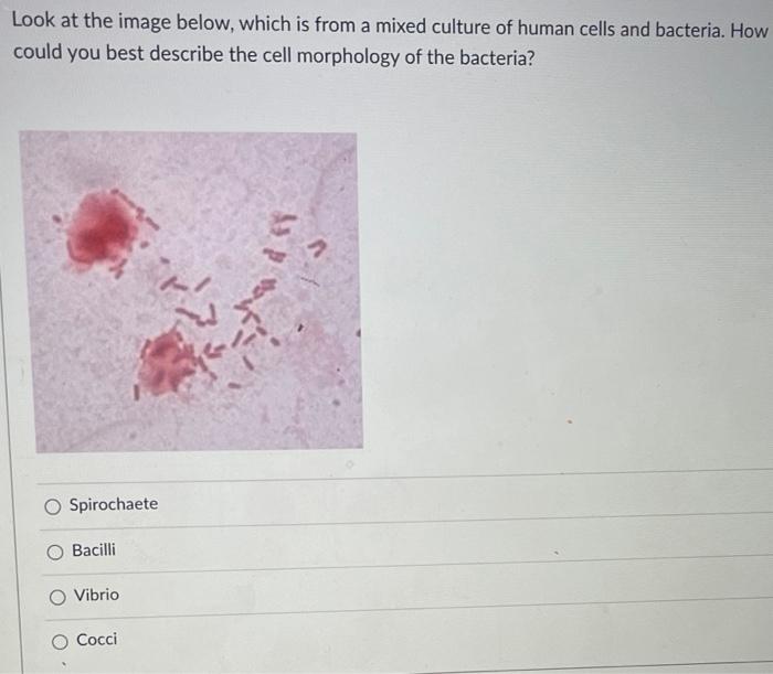 Solved Look at the image below, which is from a mixed | Chegg.com