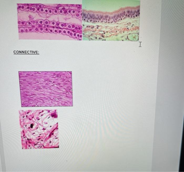 Solved I need help labeling each tissue picture as | Chegg.com