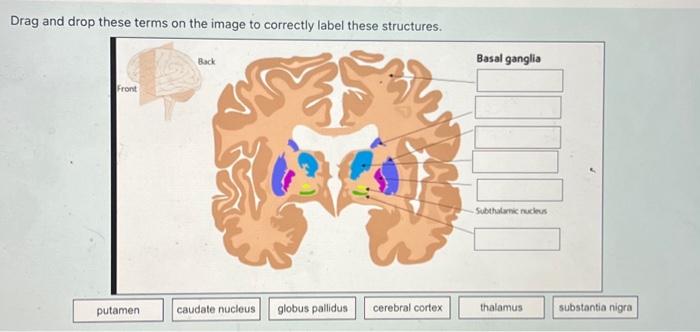 Solved Drag and drop these terms on the image to correctly | Chegg.com