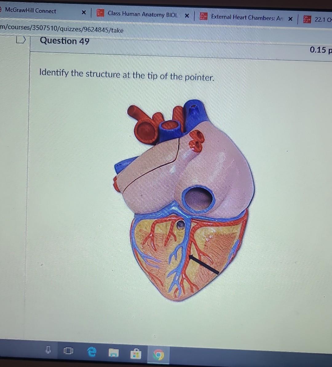 Solved Identify the part of the conducting system at the tip | Chegg.com