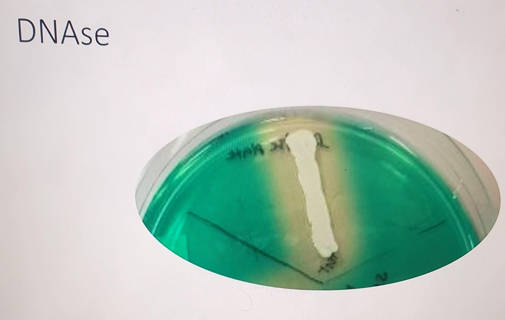 Solved DNAse | Chegg.com