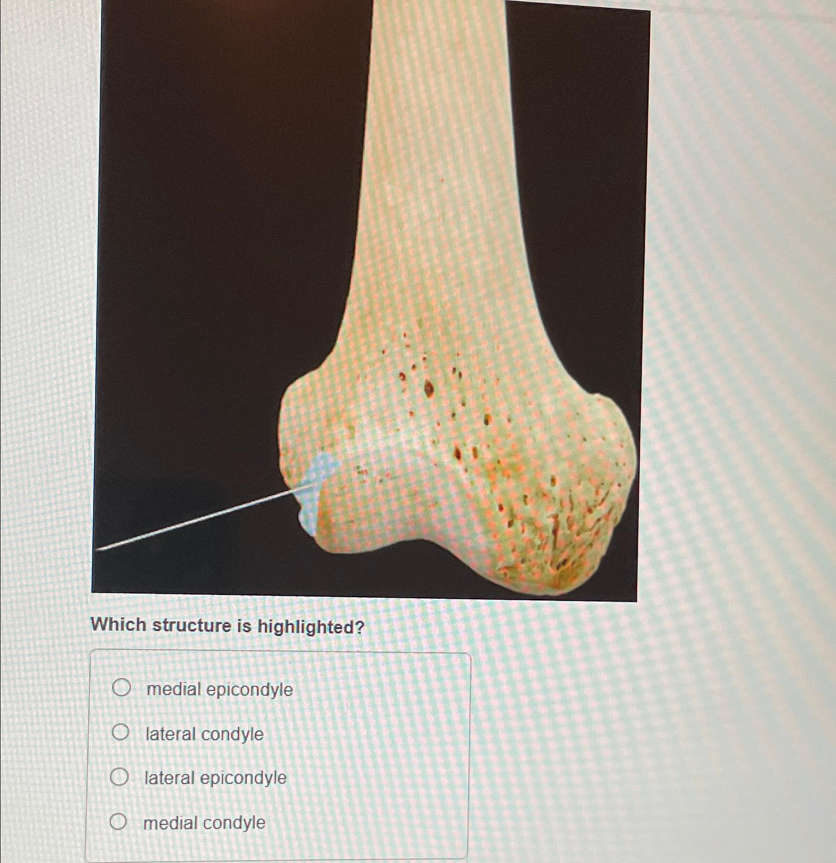 Solved Which structure is highlighted?medial | Chegg.com