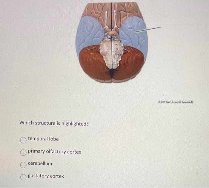 Solved Which structure is highlighted? temporal lobe primary | Chegg.com