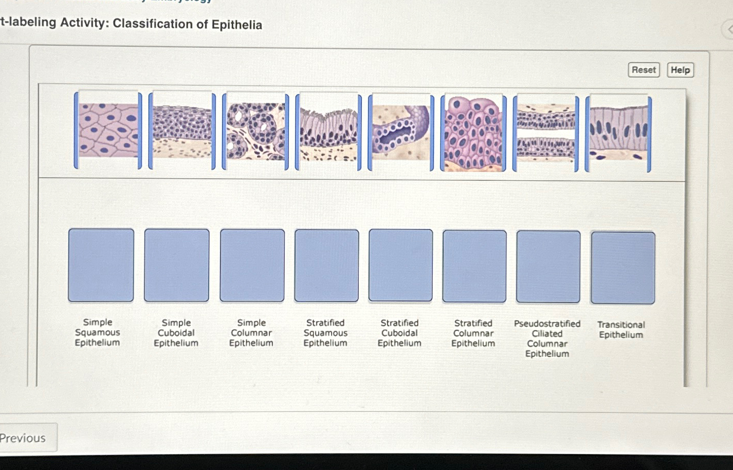 Solved t-labeling Activity: Classification of EpitheliaHelp | Chegg.com