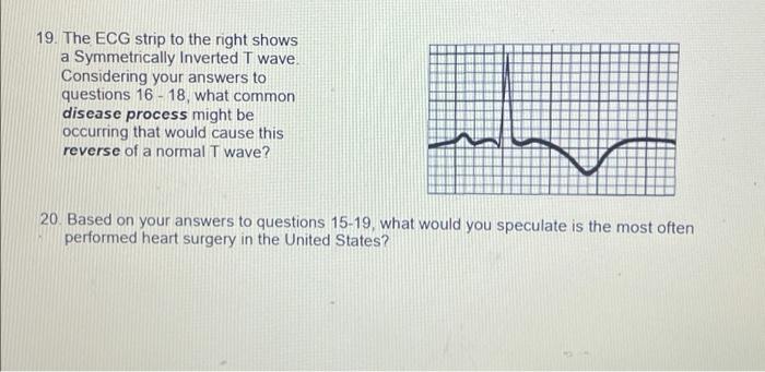 Solved 19. The ECG strip to the right shows a Symmetrically | Chegg.com