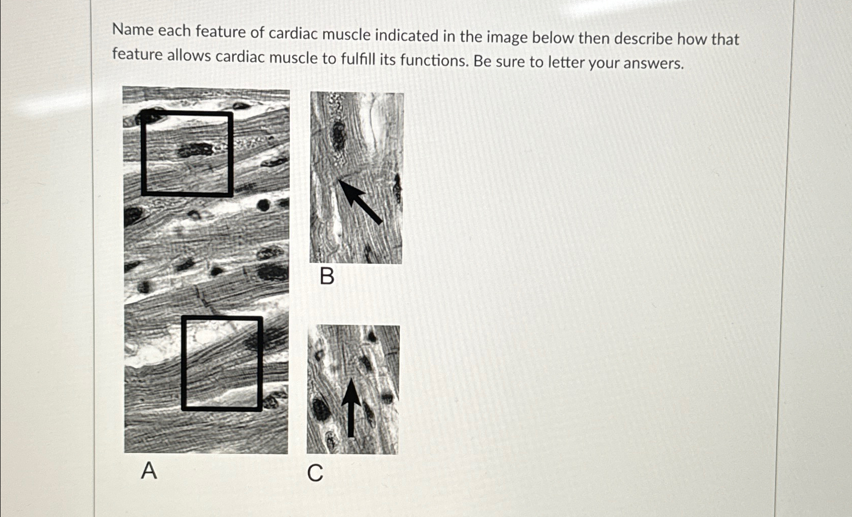 Solved Name each feature of cardiac muscle indicated in the | Chegg.com