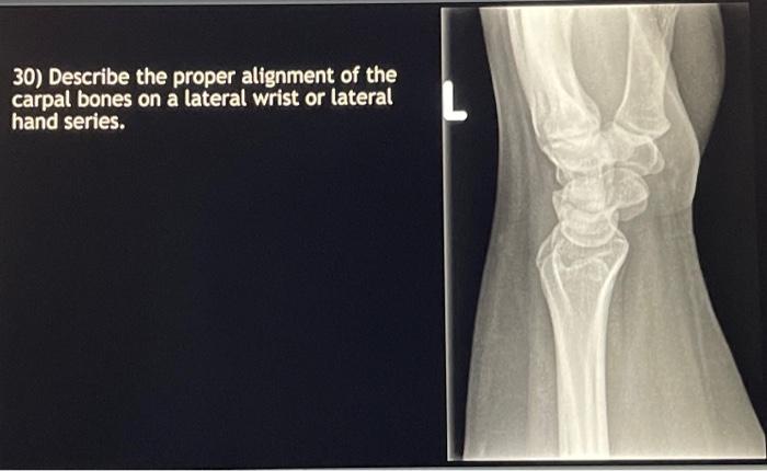 Solved 30) Describe the proper alignment of the carpal bones | Chegg.com