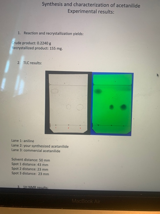 Solved Synthesis and characterization of acetanilide | Chegg.com