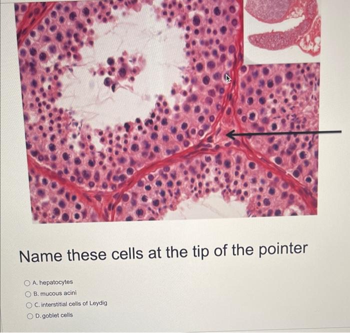 Solved Name these cells at the tip of the pointer A. | Chegg.com
