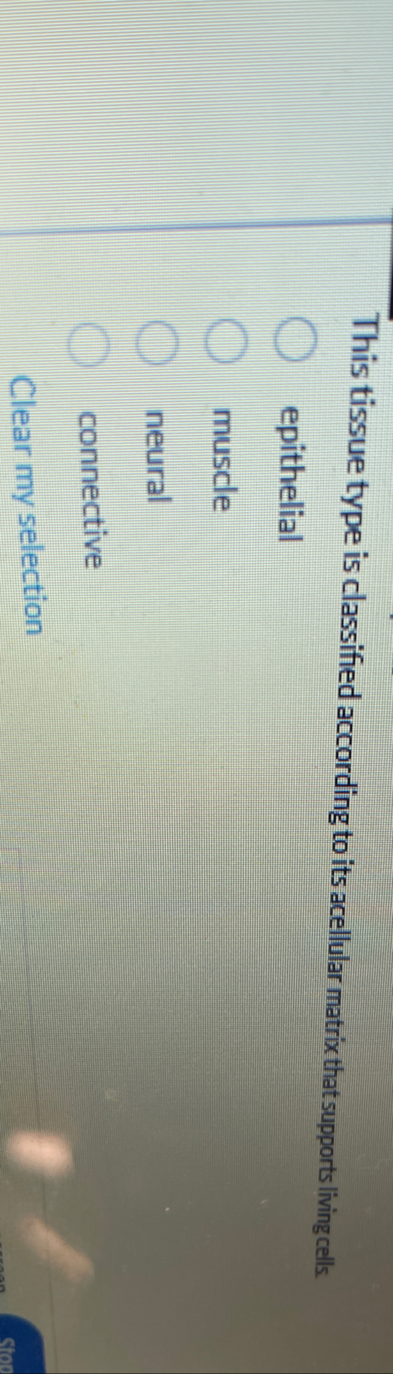 Solved This tissue type is classified according to its | Chegg.com