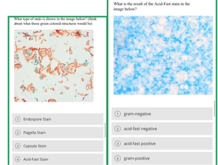 Solved What is the result of the Acid-Fast stain in the | Chegg.com